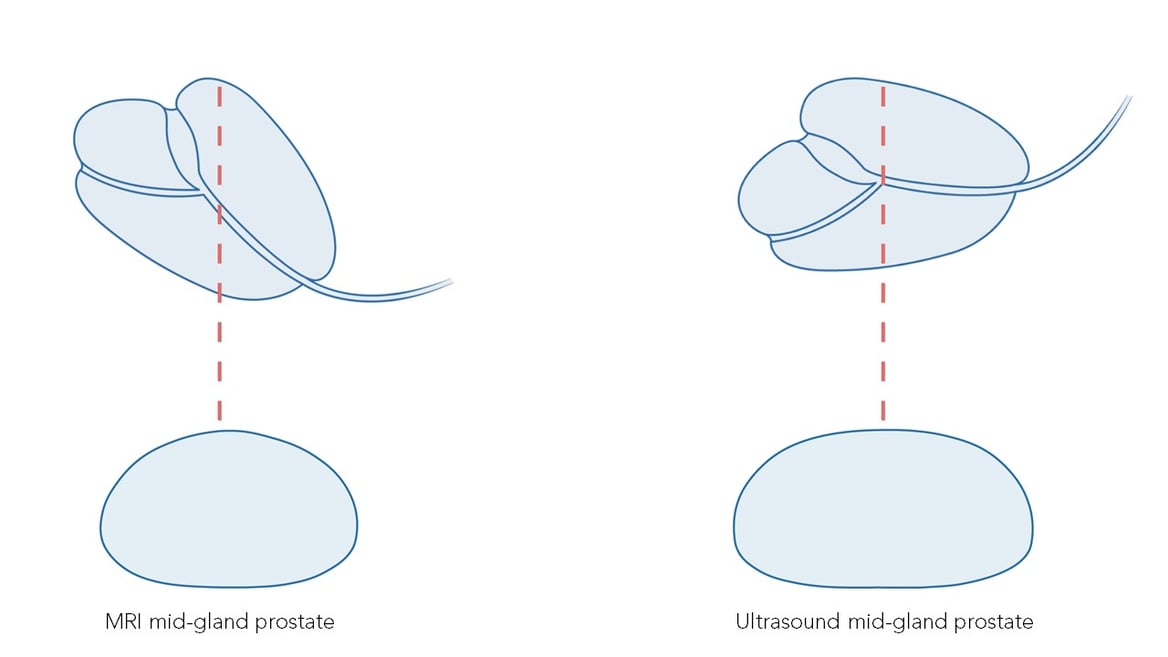 What Is Predictive Fusion?
